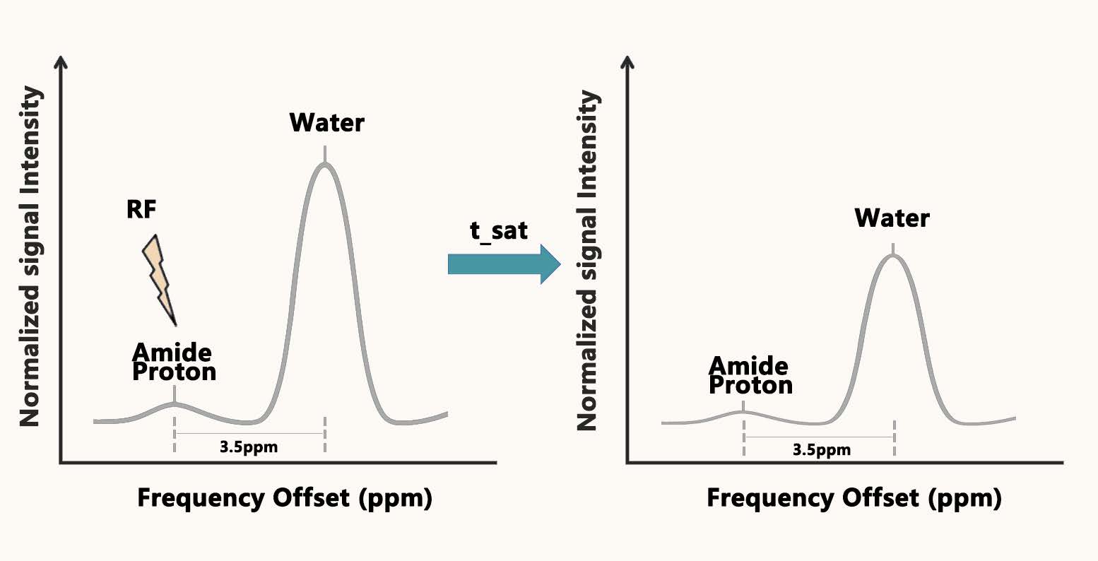 Amide Proton Transfer Imaging in the Central Nervous System: Recent ...